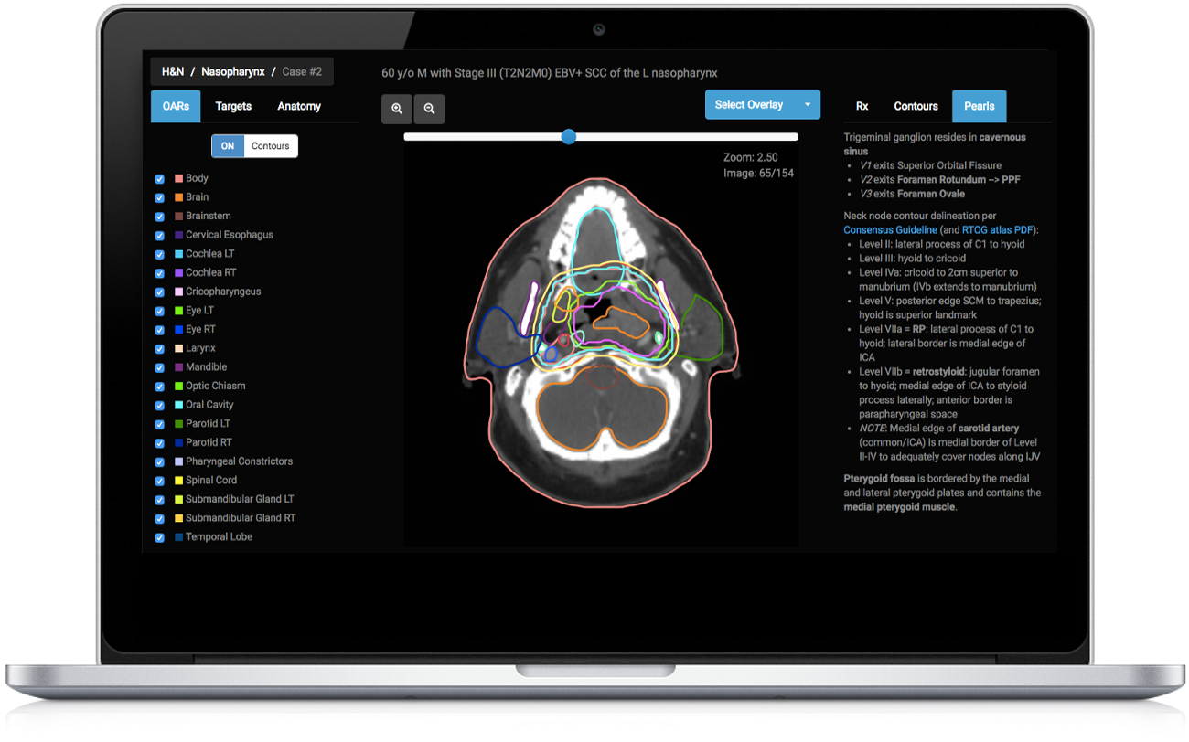 iContour | HXI - Human-centered eXtended Intelligence